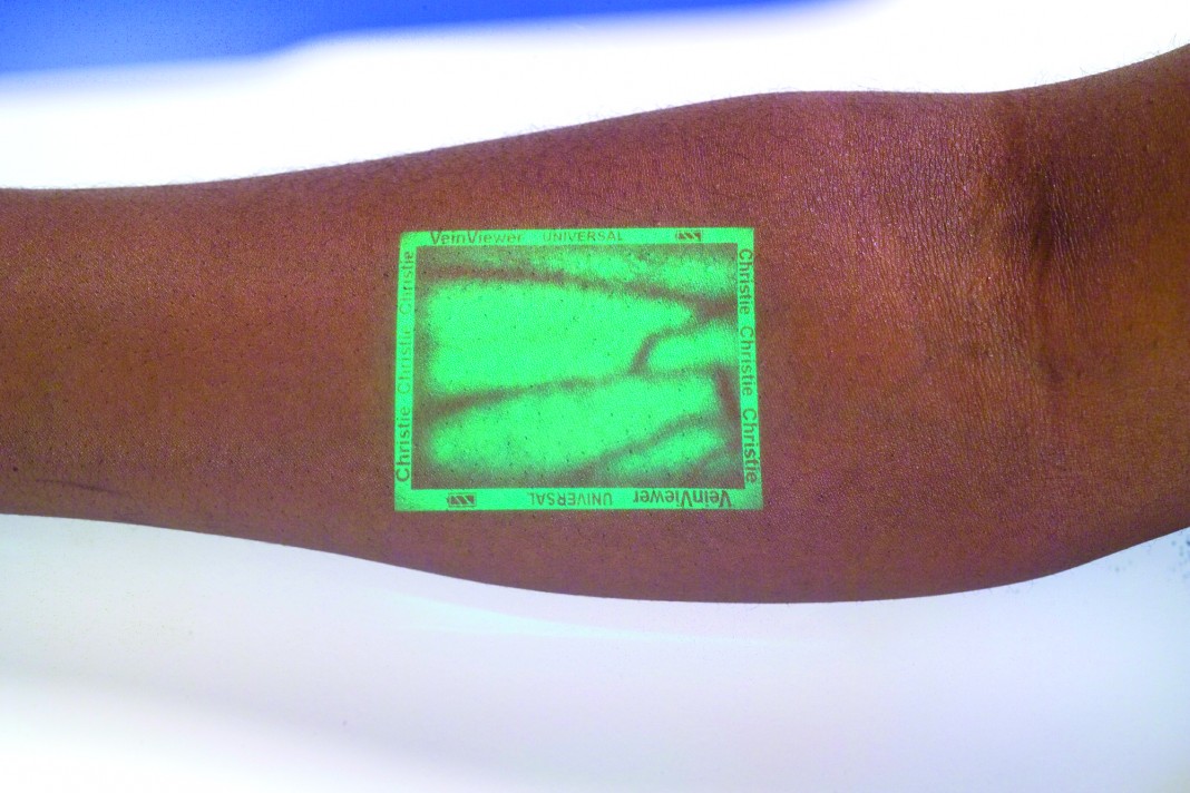 VeinViewer technology helps Baylor nursing students - The Baylor Lariat